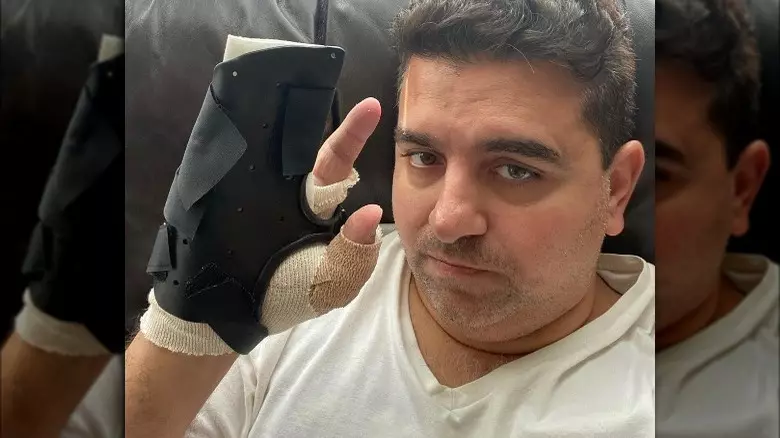 Buddy Valastro hâldt ferwûne hân op nei tredde operaasje