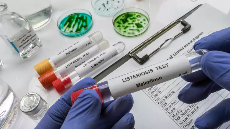 Testet e Listerias po kryhen në një laborator
