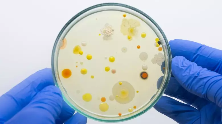 bacteria sa isang petri dish